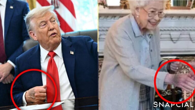 Donald Trump’s hand bruise draws comparisons to Queen Elizabeth’s mark ...